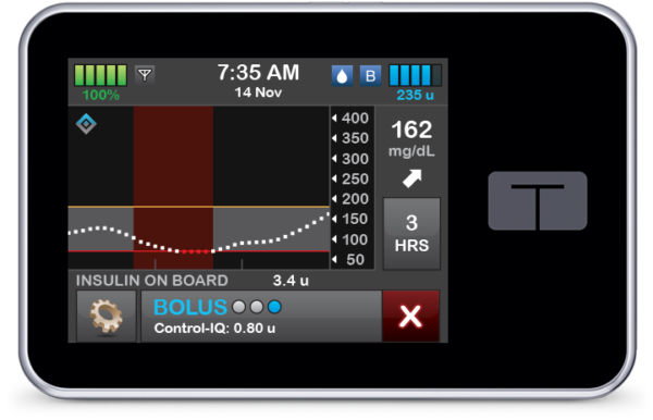 Tandem T:Slim Control IQ Pump - Southeast Diabetes, Inc Diabetic Supply ...