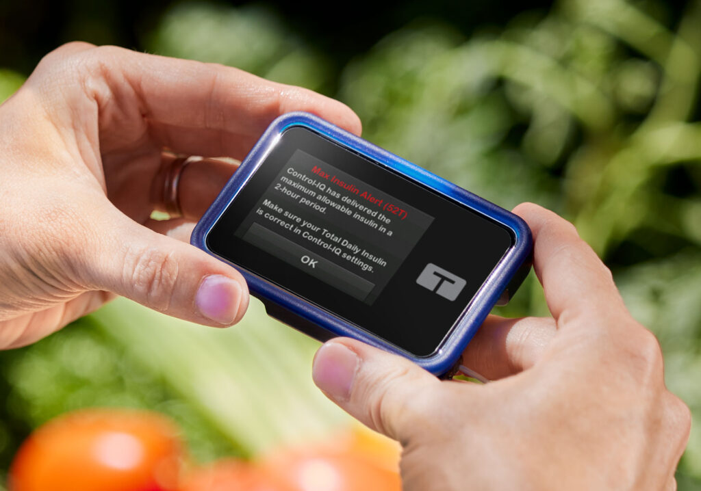 The Tandem T:Slim Control IQ Pump: Revolutionizing Diabetes Care ...